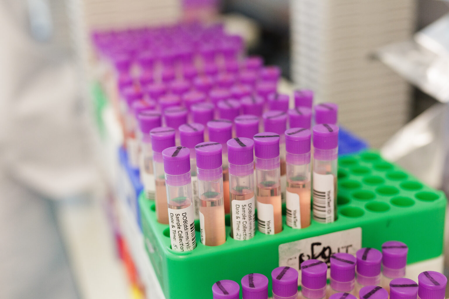 NVM announces £10 million backing of YorkTest - NVM Private Equity